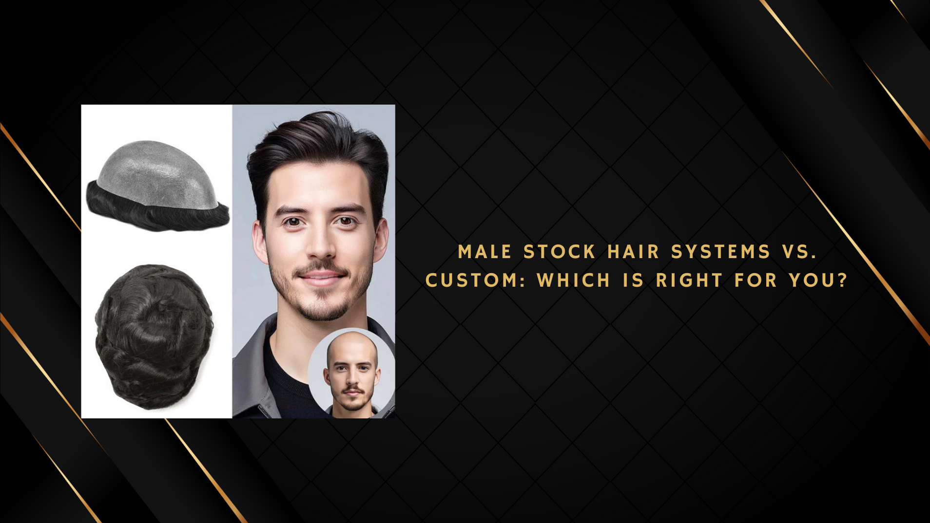Men hair replacement systems|Hair replacement for men|Toupee hair for ...